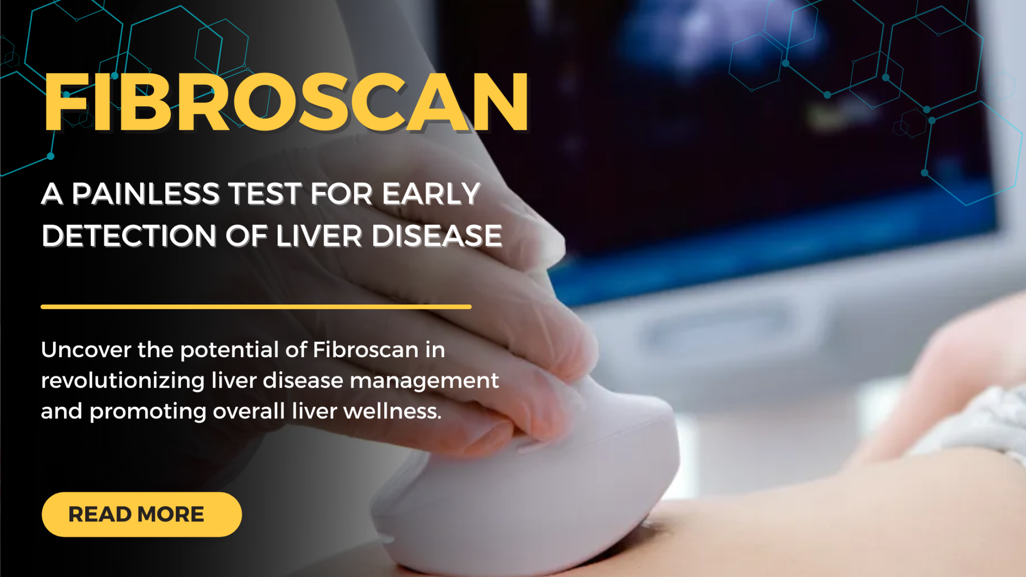 Fibroscan: A Painless Test for Early Detection of Liver Disease ...